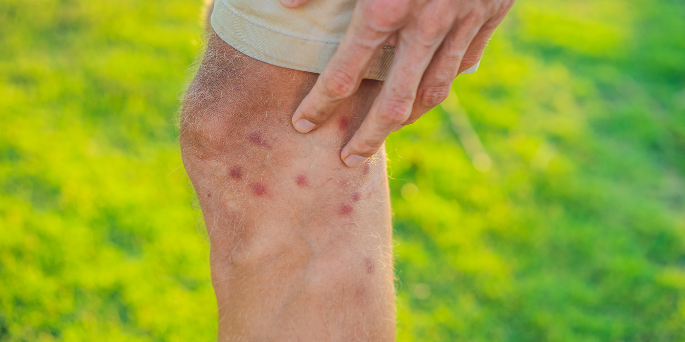 Treat Outdoor Fleas With Chemical and Natural Methods