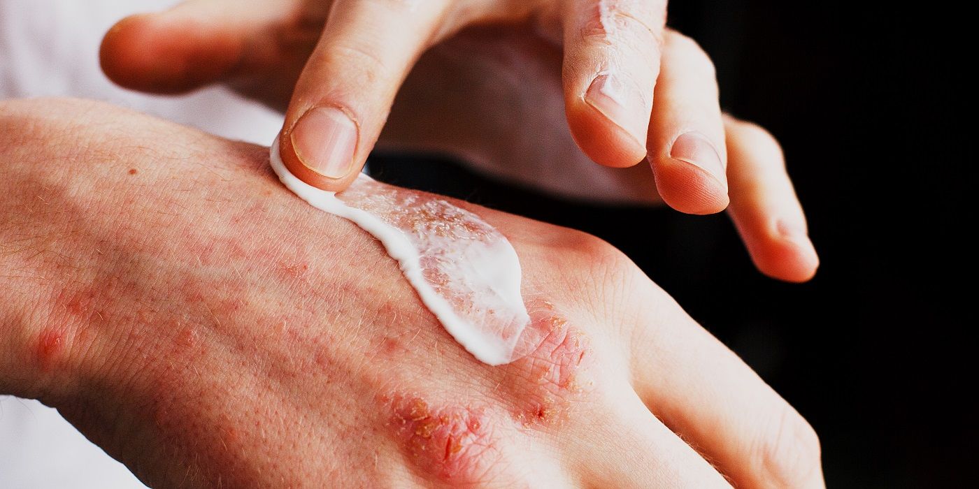 A Deadly Encounter: The Menacing Gympie Gympie Tree