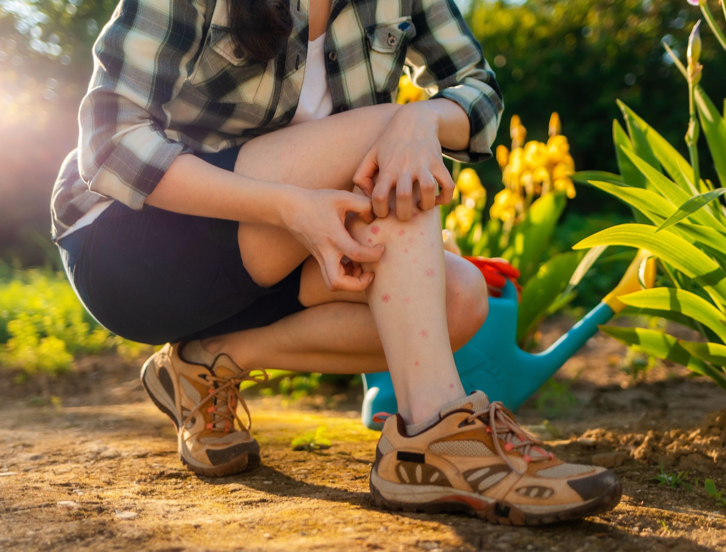 West Nile Virus: Spot the Symptoms And Stay Informed