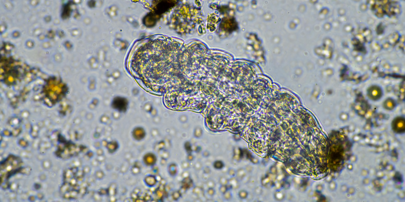 The Gut-Garden Connection: How Soil Impacts Gut Health